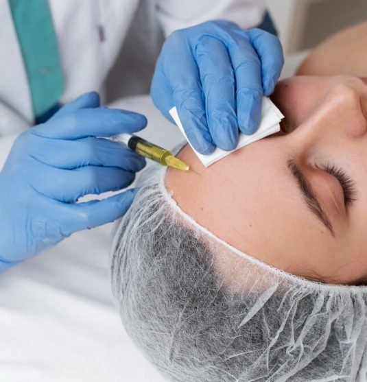 Platelet Rich Plasma infusion(Face) - Casa derma